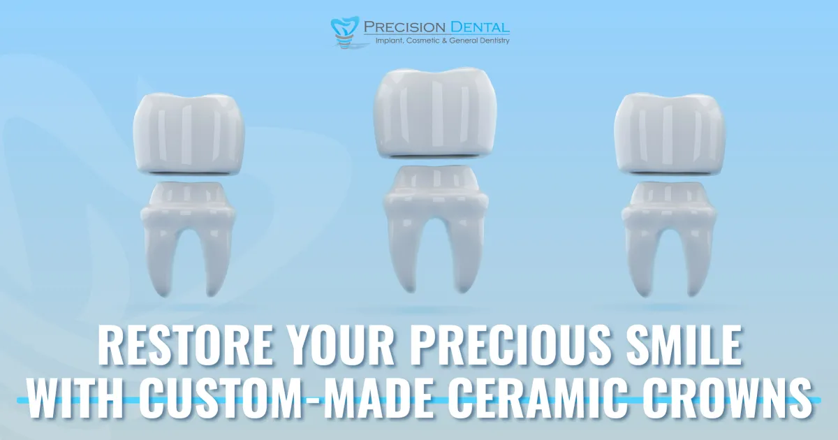 Ceramic Dental Crowns By Dentist in Glendale, CA