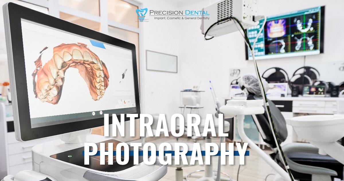 Intraoral Photography Dental Office in Glendale, CA